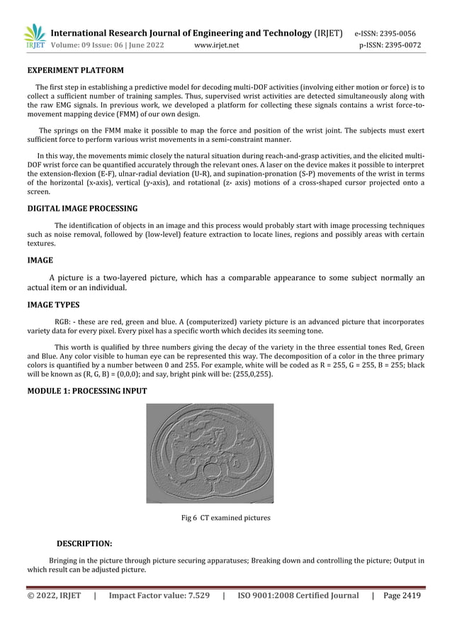 Detection of Kidney Stone using Neural Network Classifier | PDF