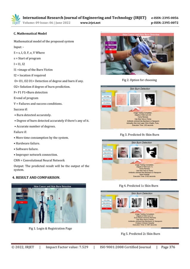 Skin Burn and Skin Cancer Detection Using Image Processing | PDF