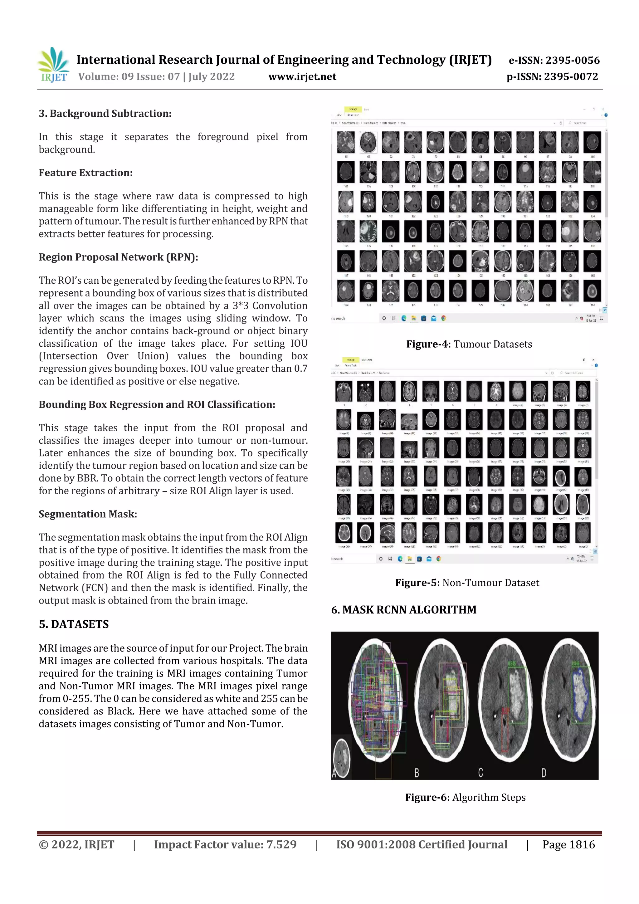 A REVIEW ON BRAIN TUMOR DETECTION FOR HIGHER ACCURACY USING DEEP NEURAL NETWORK AND MASK RCNN | PDF