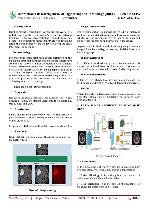 A Review On Brain Tumor Detection For Higher Accuracy Using Deep Neural