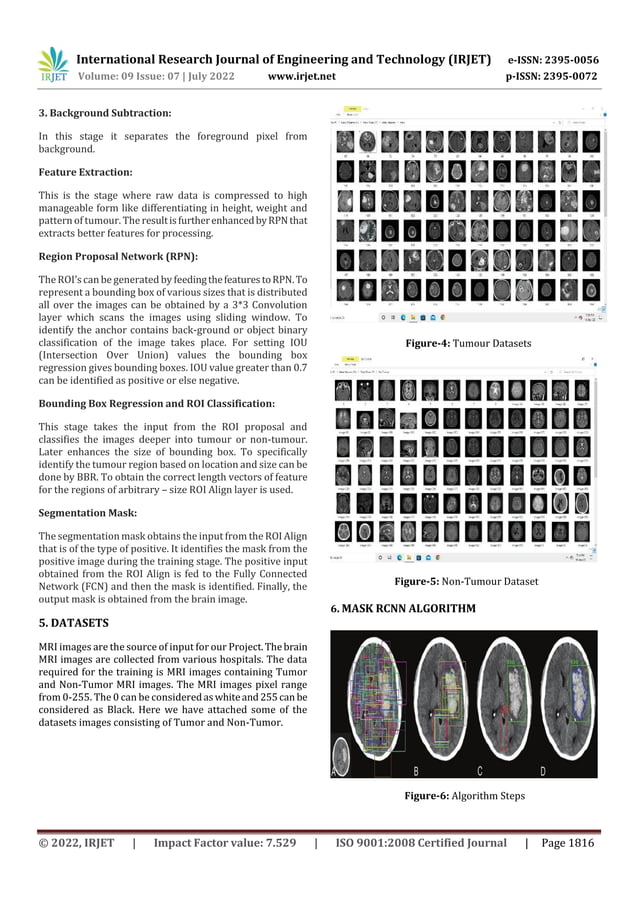 A REVIEW ON BRAIN TUMOR DETECTION FOR HIGHER ACCURACY USING DEEP NEURAL NETWORK AND MASK RCNN | PDF