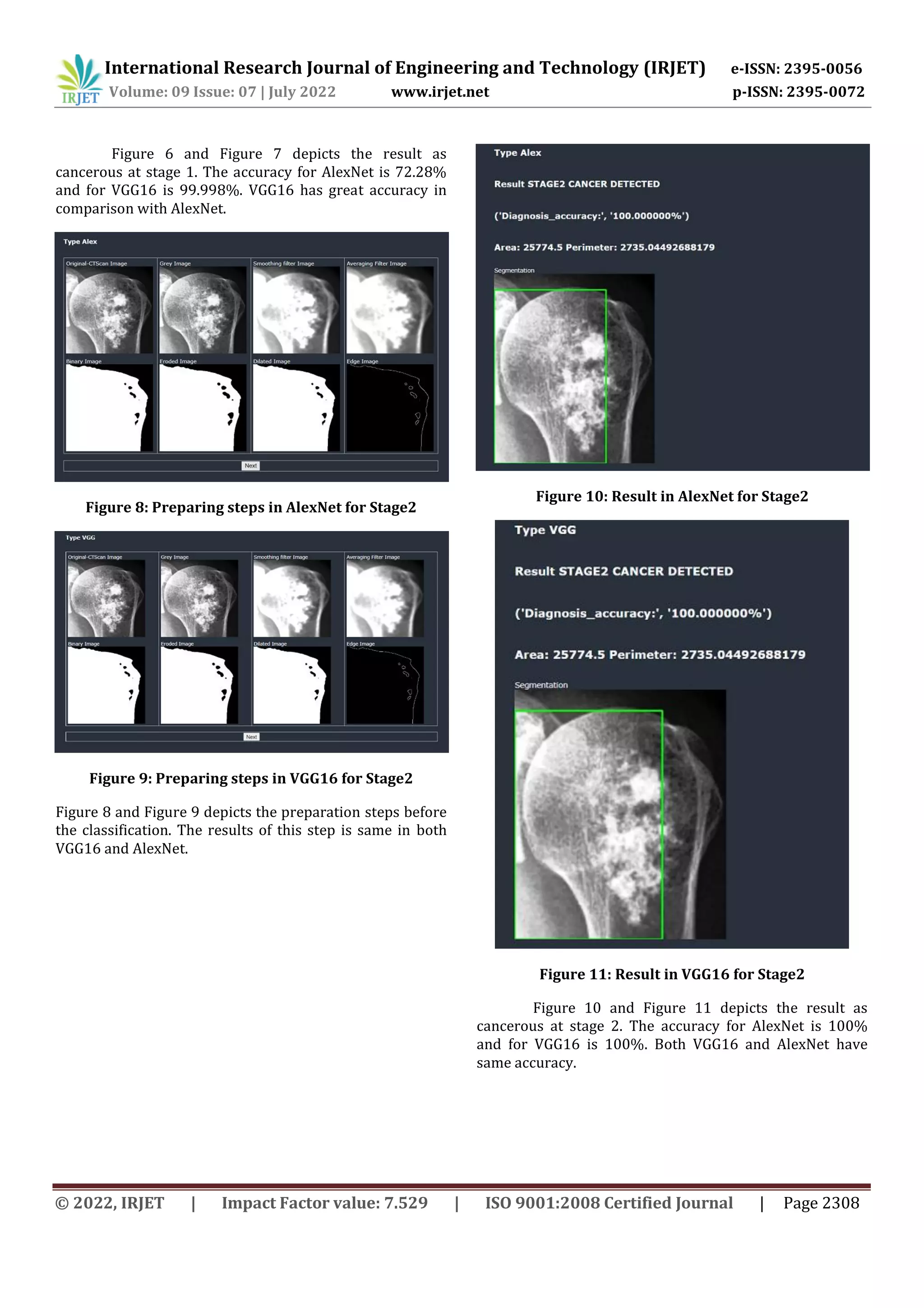 Bone Cancer Detection using AlexNet and VGG16 | PDF | Bone and Joint Conditions | Diseases and ...