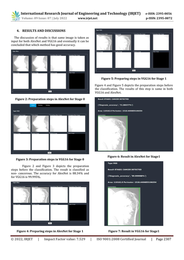 Bone Cancer Detection using AlexNet and VGG16 | PDF | Bone and Joint Conditions | Diseases and ...
