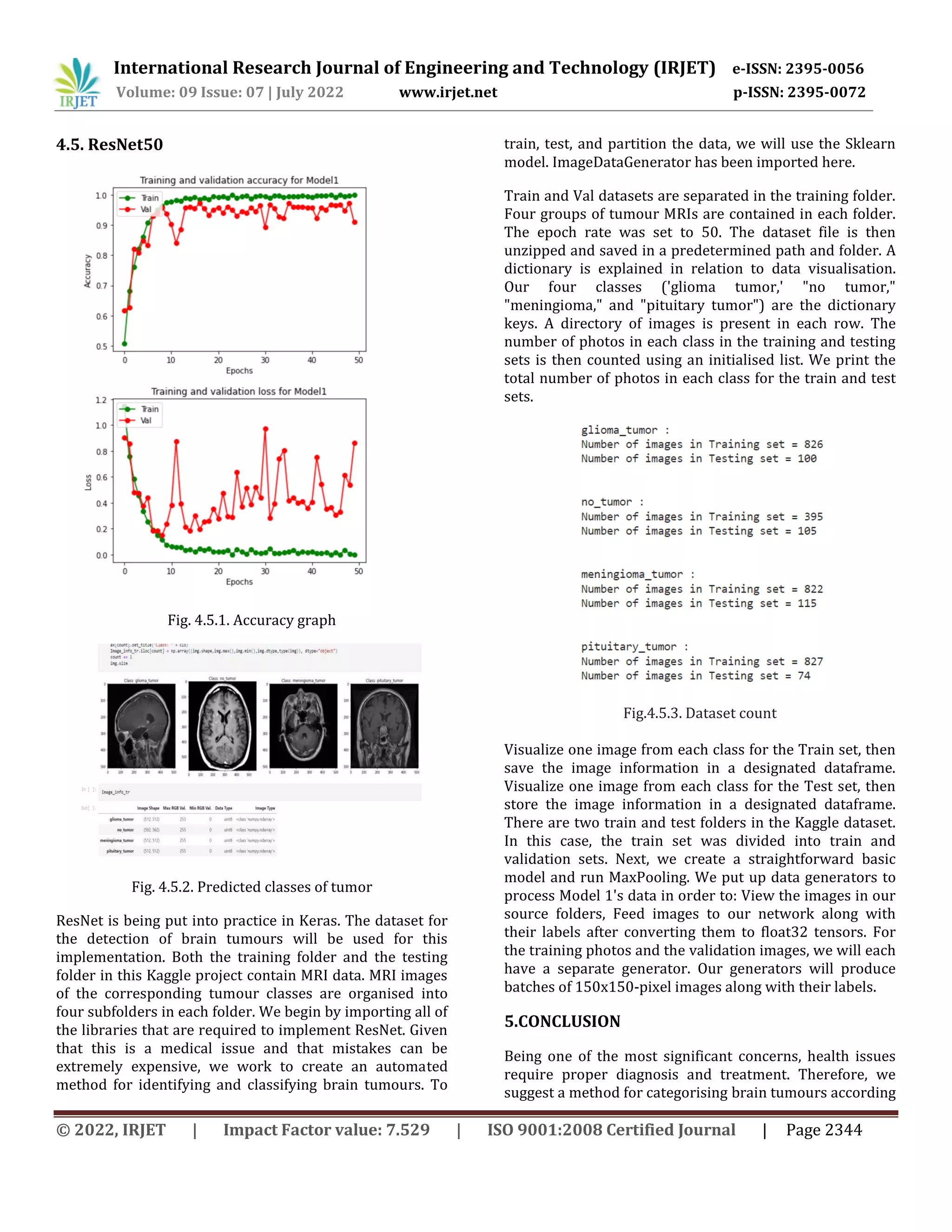AI Based Approach for Classification of MultiGrade Tumour in Human Brain | PDF