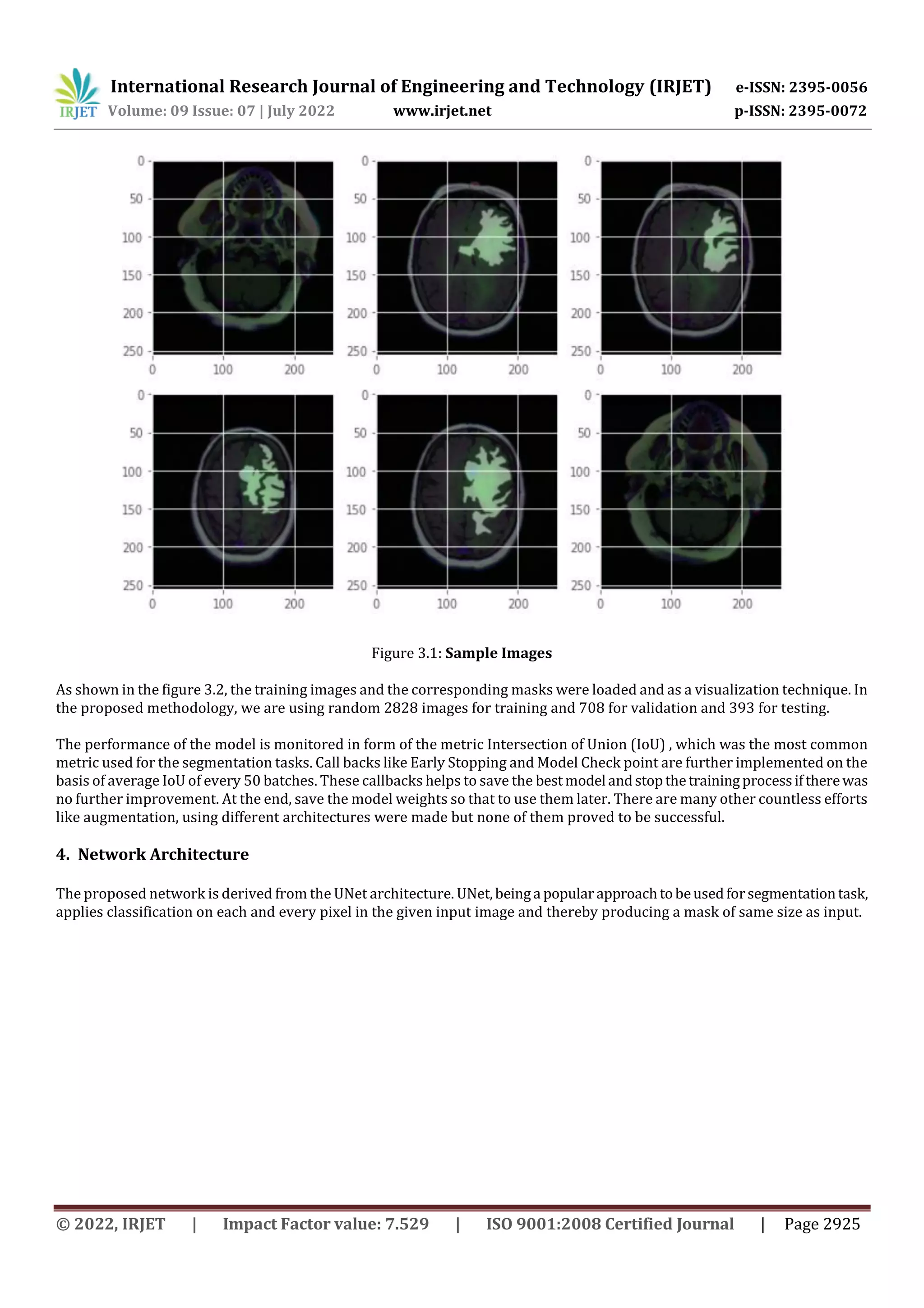 Improved UNet Framework with attention for Semantic Segmentation of Tumor Regions in Brain MRI ...