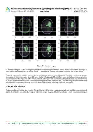 Improved UNet Framework with attention for Semantic Segmentation of Tumor Regions in Brain MRI ...