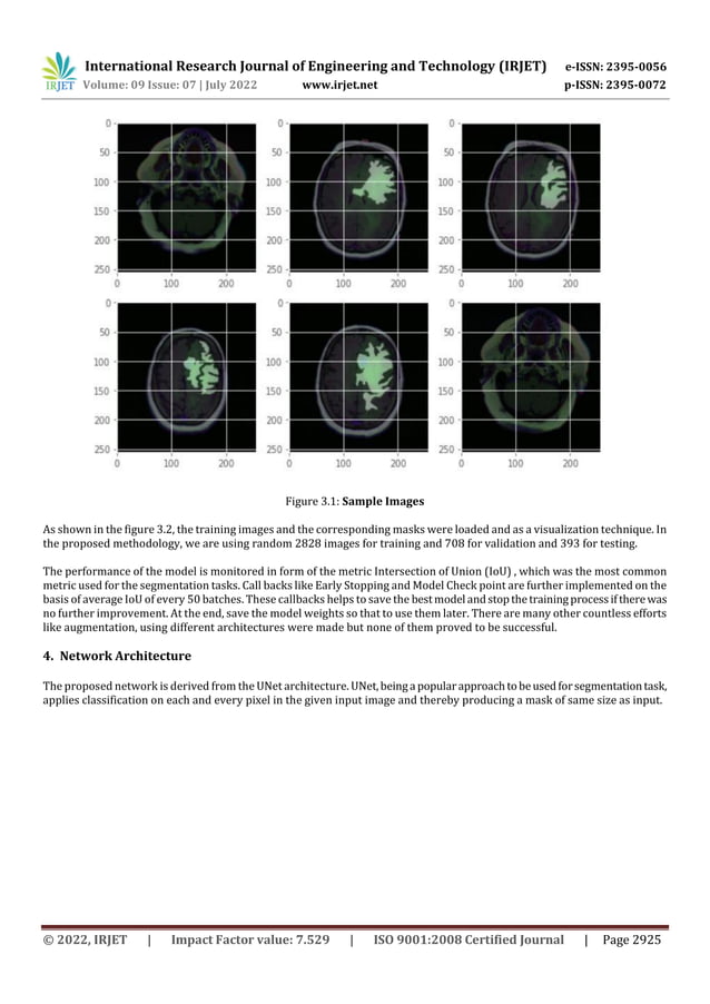 Improved UNet Framework with attention for Semantic Segmentation of Tumor Regions in Brain MRI ...