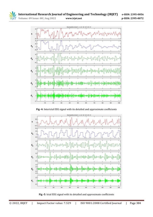 Wavelet-Based Approach for Automatic Seizure Detection Using EEG Signals | PDF