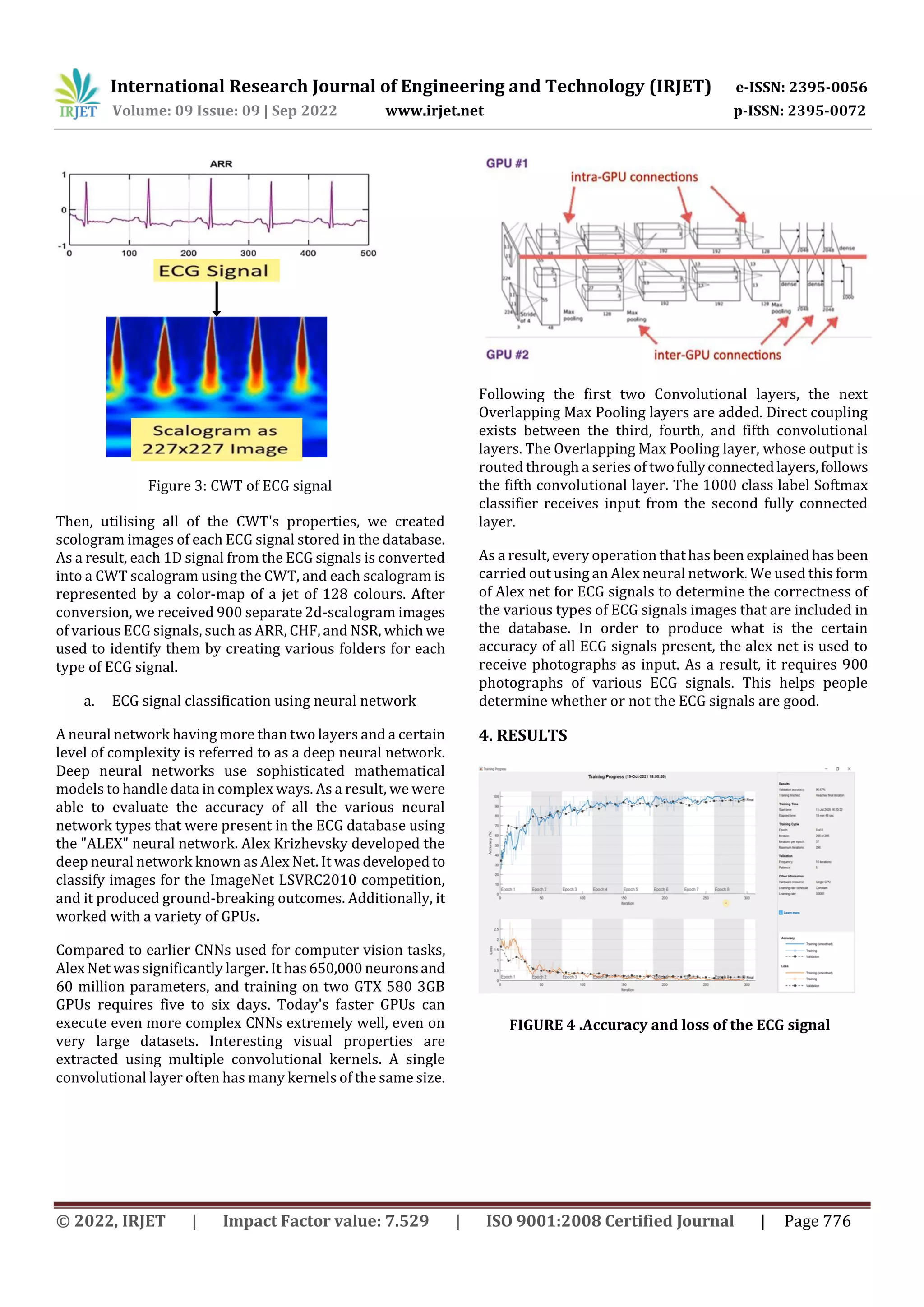 Ecg Signal Analysis Using Continuous Wavelet Transformation And Deep Neural Network Pdf