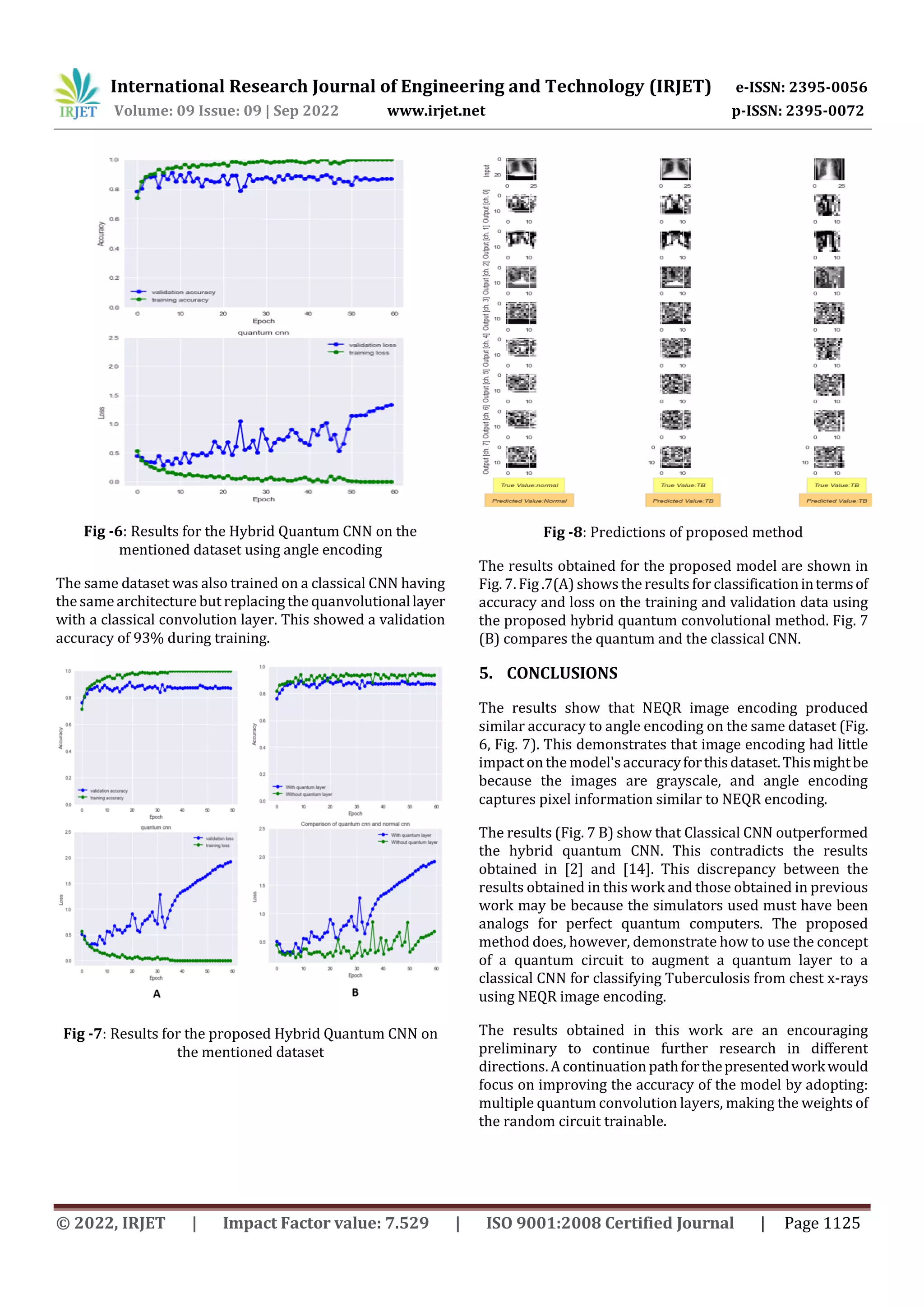 Hybrid Quantum Convolutional Neural Network for Tuberculosis Prediction Using Chest X-Ray Images ...