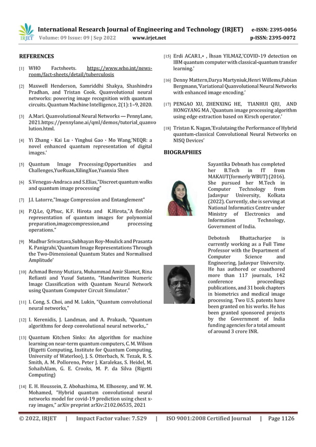 Hybrid Quantum Convolutional Neural Network For Tuberculosis Prediction Using Chest X Ray Images