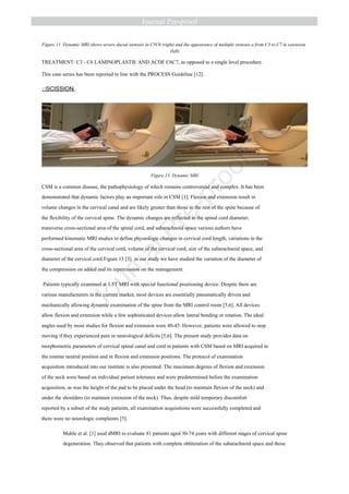 The value of dynamic MRI in cervical spondylotic myelopathy: About 24 ...