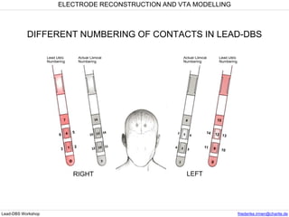 Electrode Reconstructions VTA Modelling | PPT