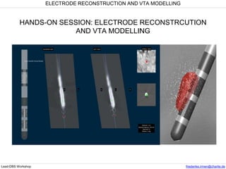 Electrode Reconstructions VTA Modelling | PPT