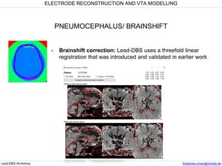 Electrode Reconstructions VTA Modelling | PPT