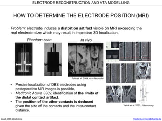 Electrode Reconstructions VTA Modelling | PPT