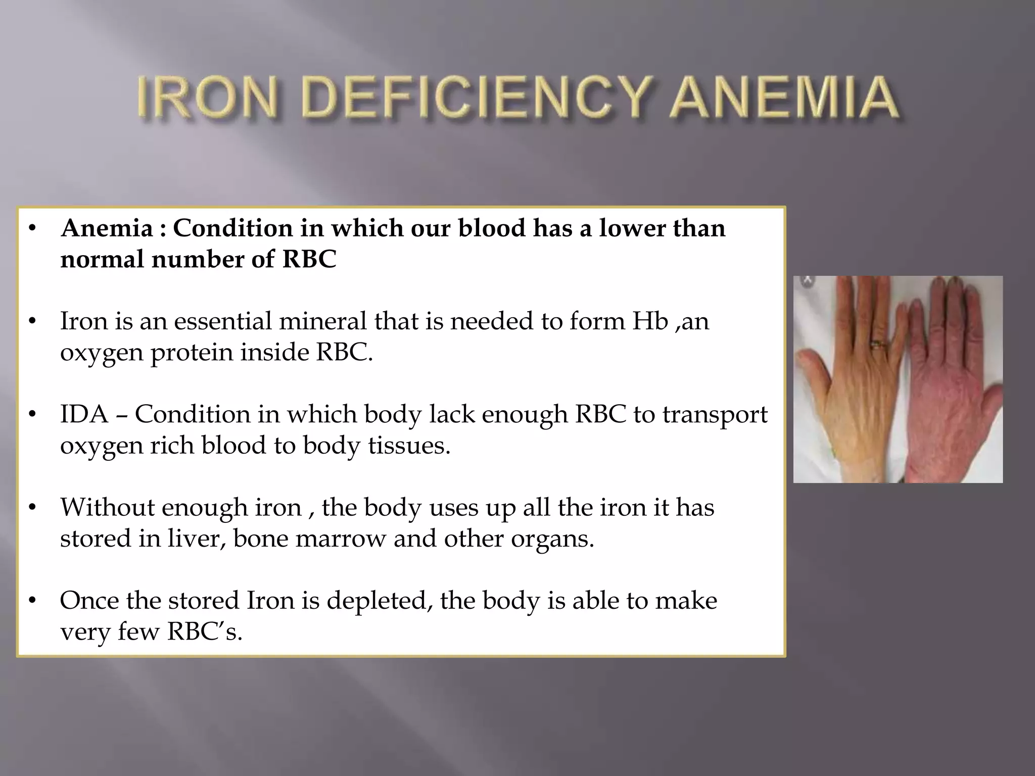 Iron Deficiency Disease | PPTX
