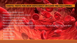 IRON DEFICIENCY.pdf