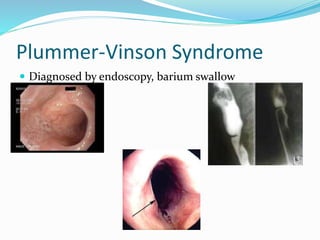 IRON DEFICIENCY.pptx