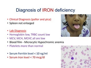 Iron deficiency 2021 | PDF