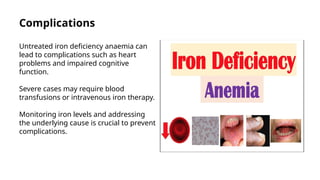 Iron Deficiency Anaemia.pptxhshhshjdjjjj | PPTX