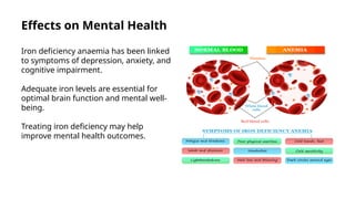 Iron Deficiency Anaemia.pptxhshhshjdjjjj | PPTX