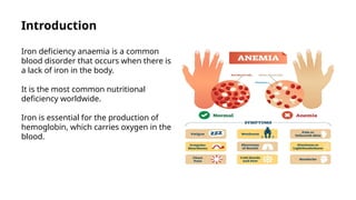 Iron Deficiency Anaemia.pptxhshhshjdjjjj | PPT