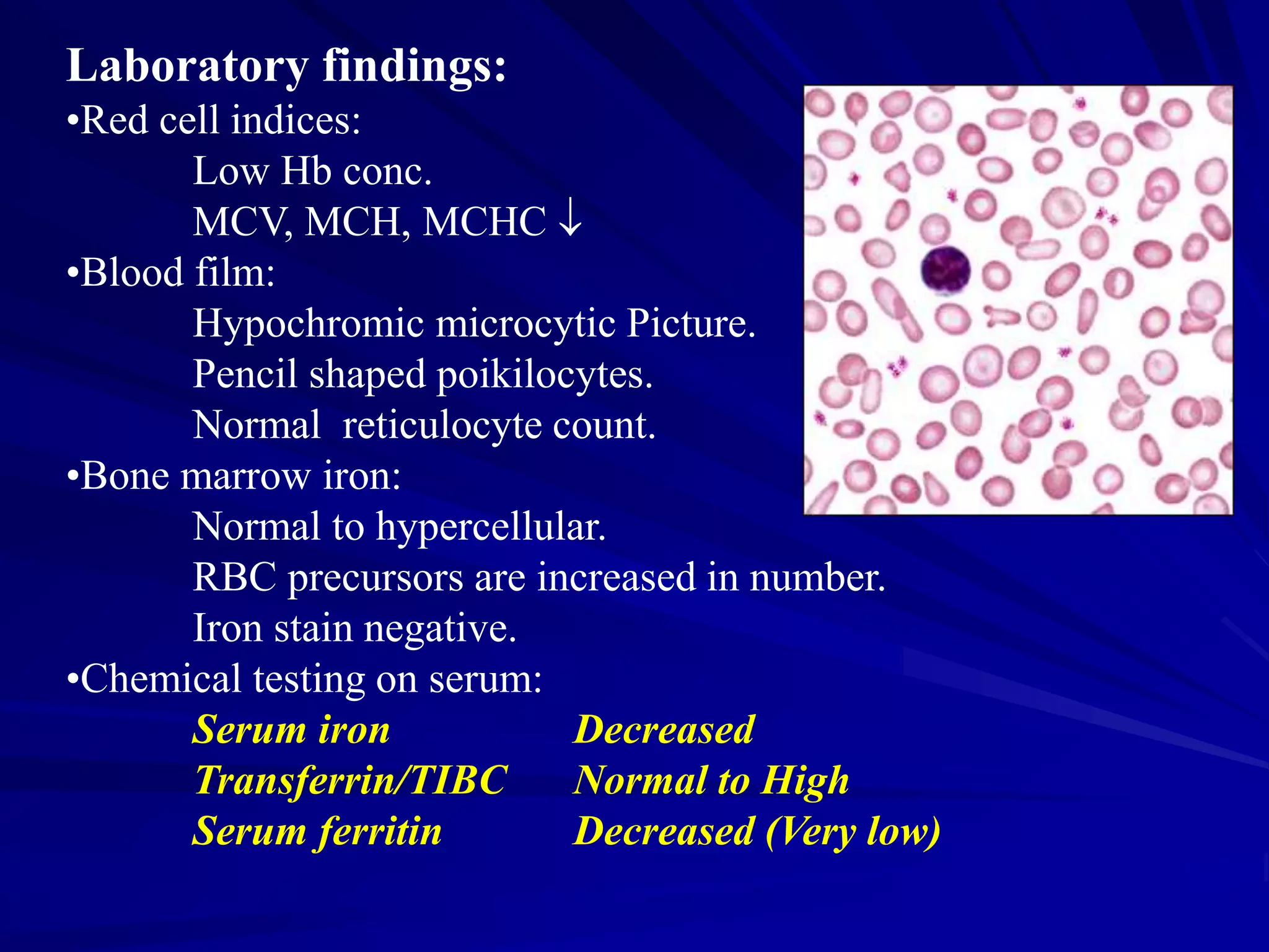 Iron deficiency anaemia 2018 | PPTX