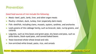 Iron deficiency anemia | PPTX