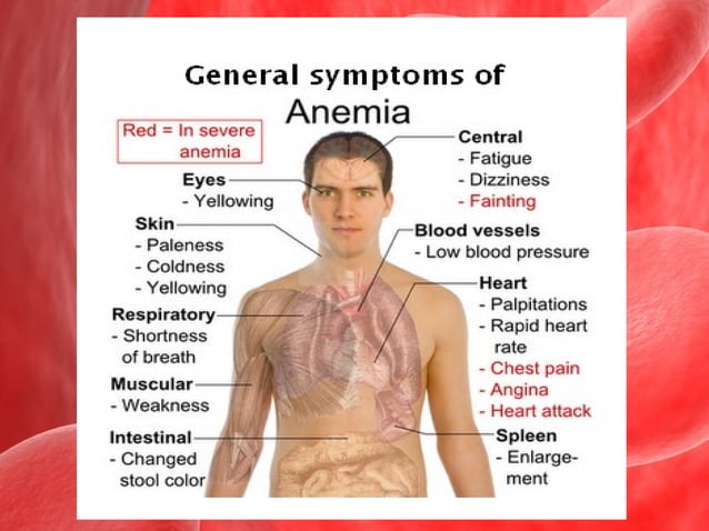 Iron deficiency anemia | PPT
