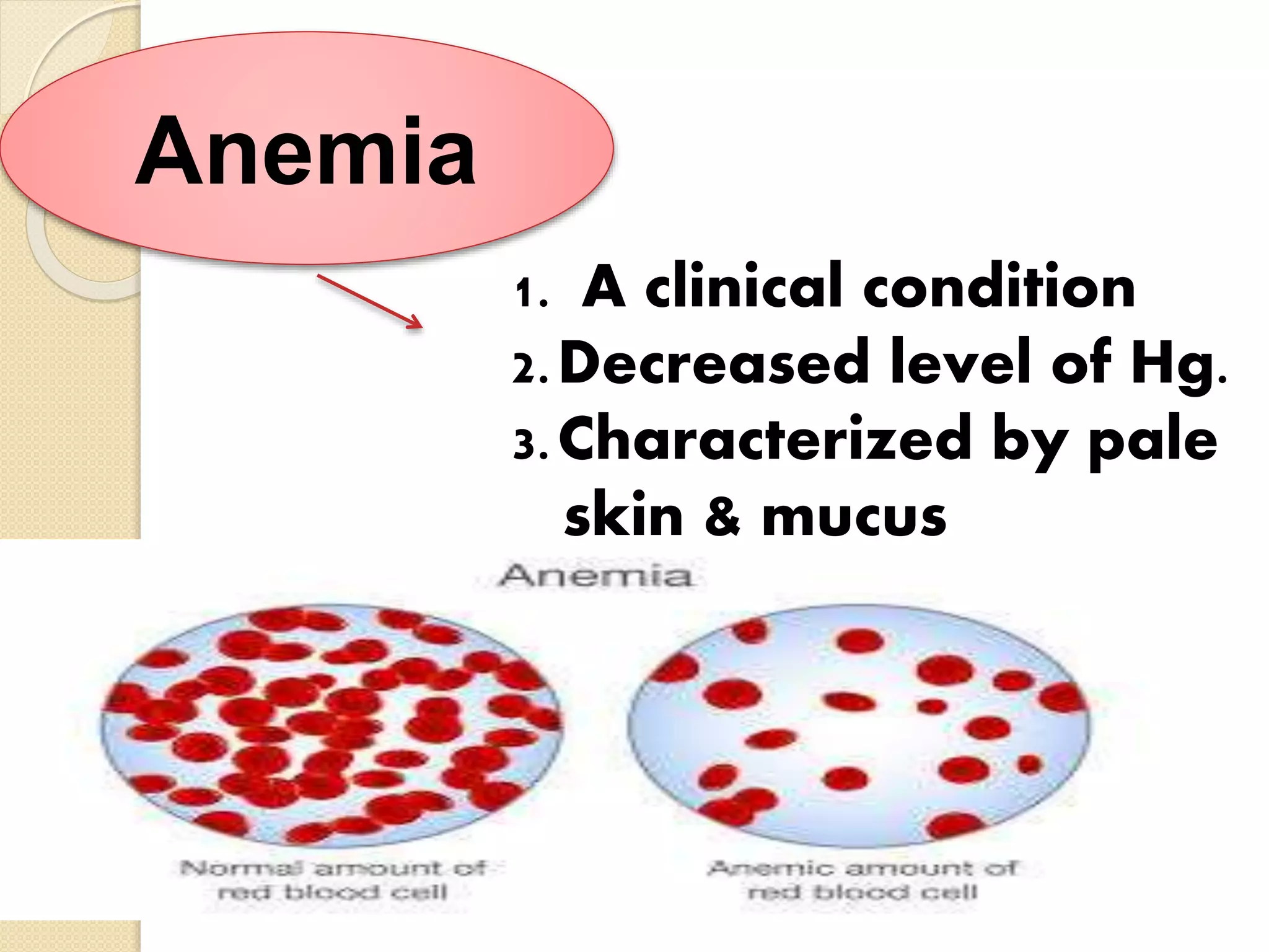 Iron deficiency anemia | PPTX