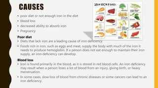Iron deficiency anemia | PPTX