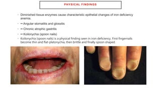 Iron deficiency anemia | PPT