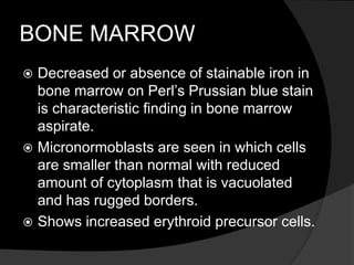 IRON DEFICIENCY ANEMIA .pptx