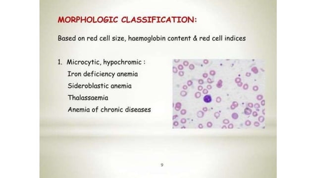 Deficiency of Iron is called anemia .pptx | Blood Disorders | Diseases and Conditions