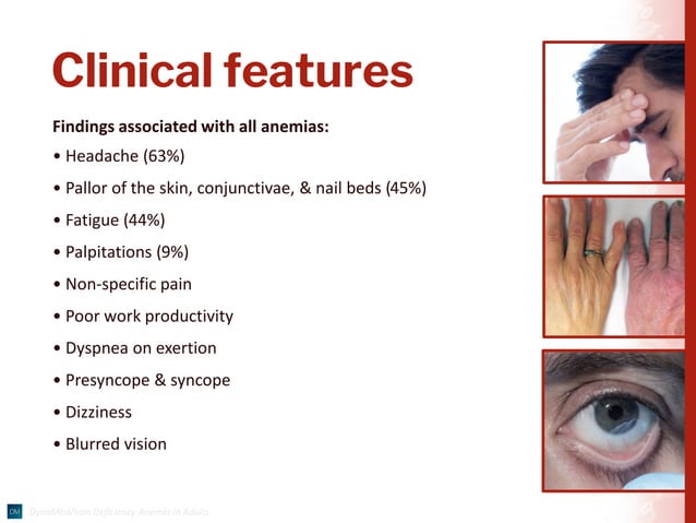 Iron deficiency anemia (IDA) Diagnosis & Management | PPT