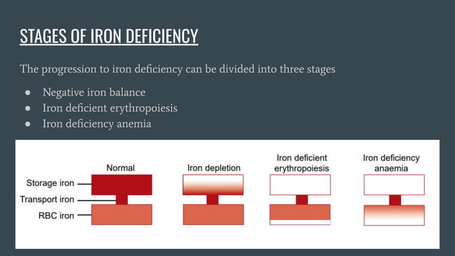 Iron Deficiency Anemia - Etiology , Clinical Features and Management.pdf