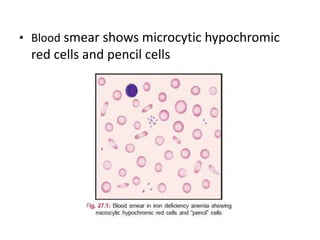 IRON DEFICIENCY ANEMIA AND ITS LAB DIAGNOSIS.pptx