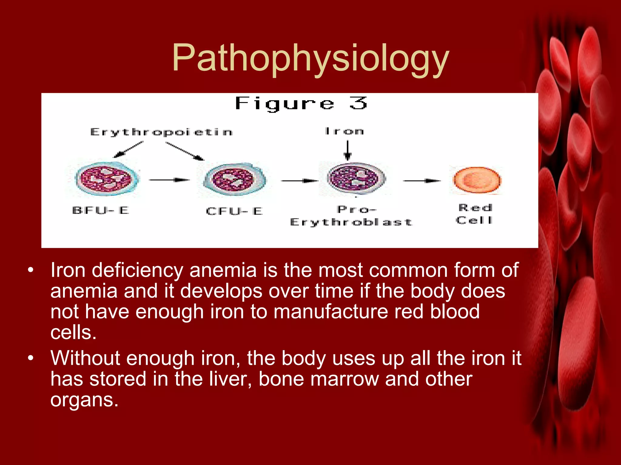 Iron deficiency anemia. | PPT