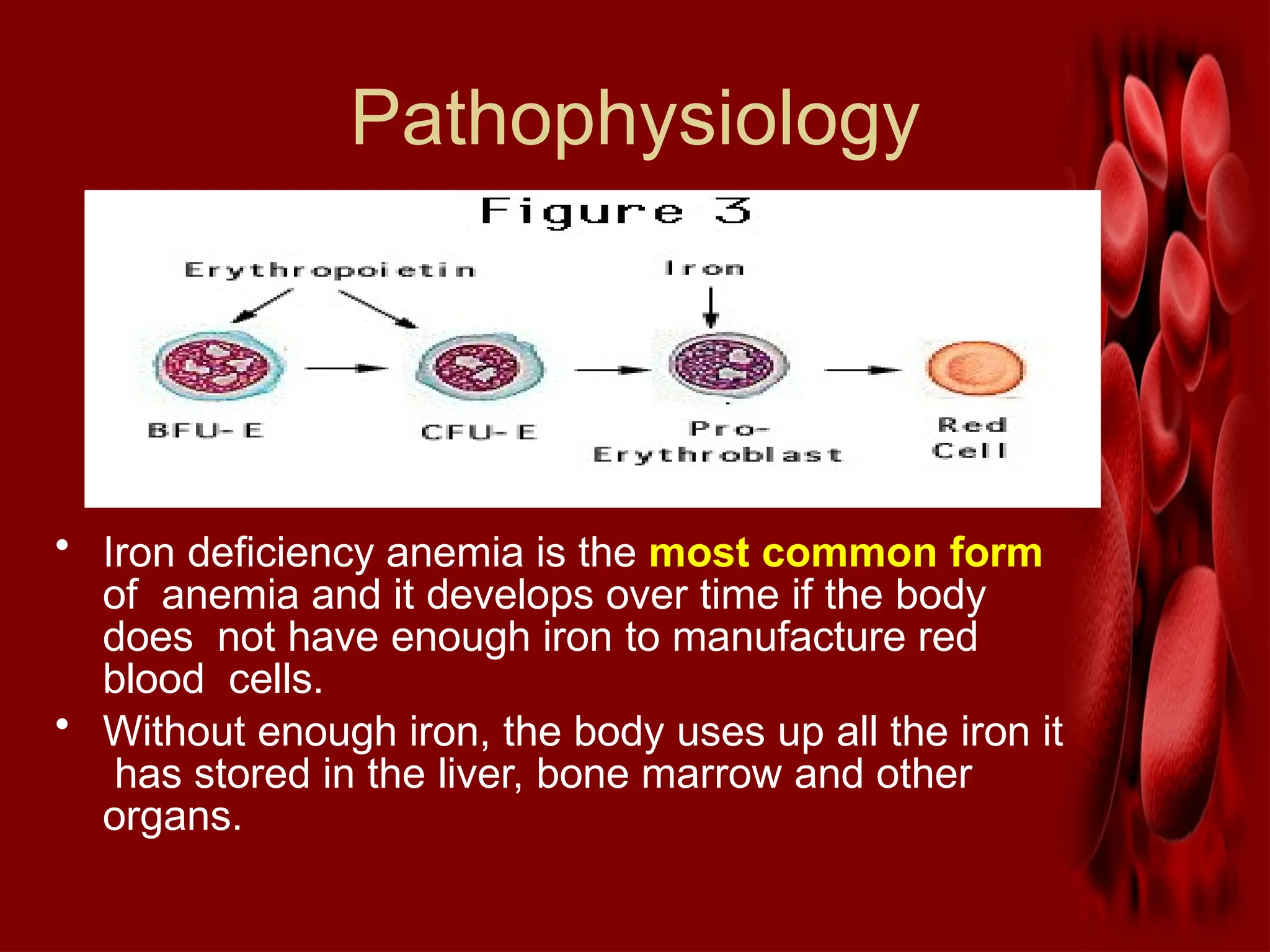irondeficiencyanemiafinal ptx slides.... | PPTX