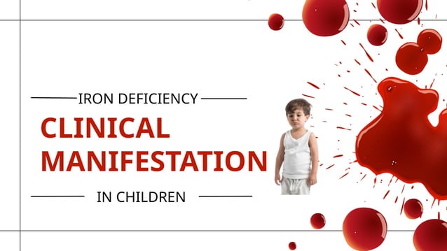 Iron deficiency Anemia in children pptxn | PPTX