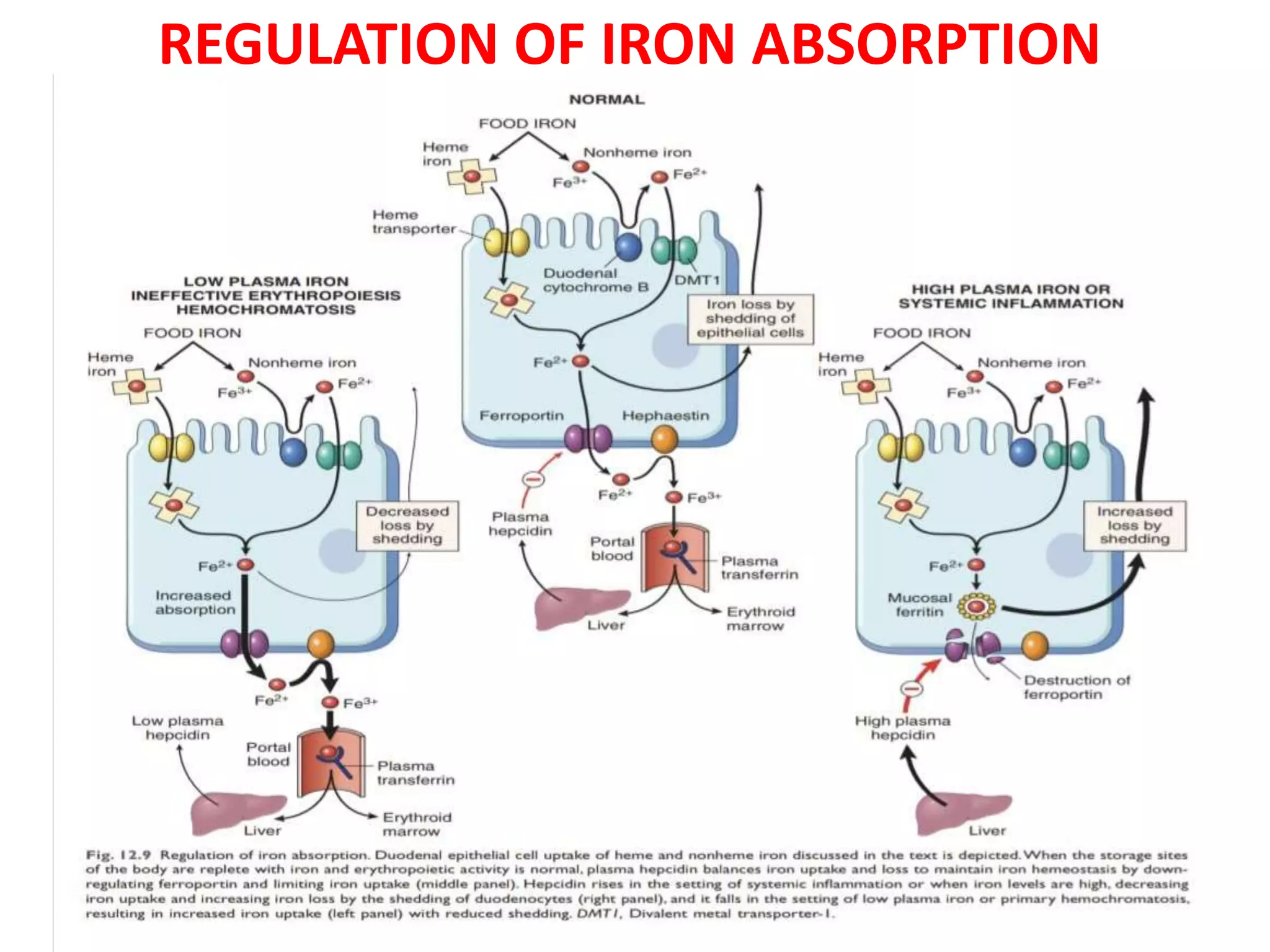 iron deficiency anemia &Iron poisoning.pptx