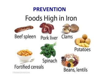Iron deficiency anaemia treatment | PPTX
