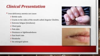 Iron Deficiency .pptx