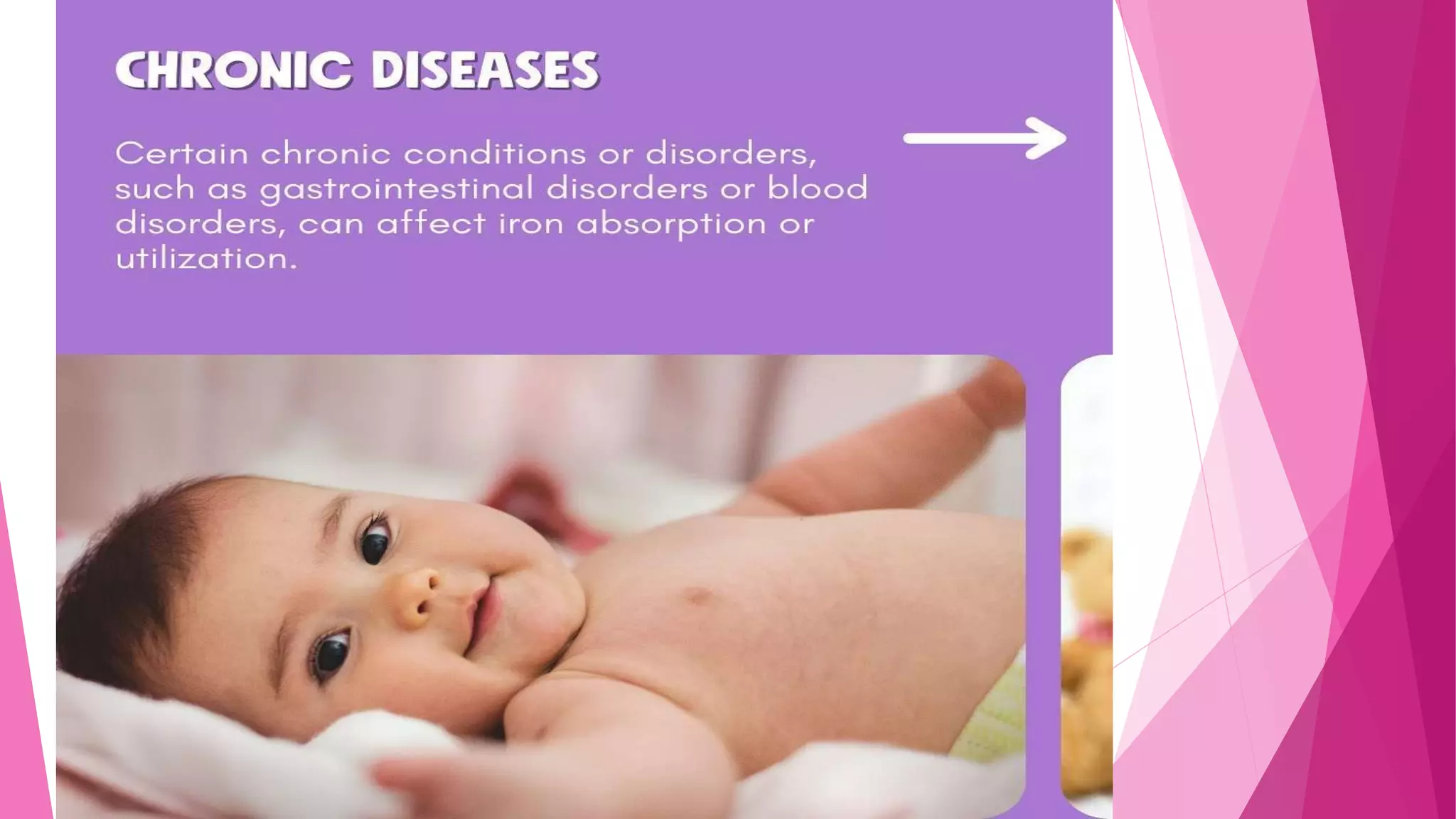 Iron Deficiency in Your Baby or Toddler | PPTX