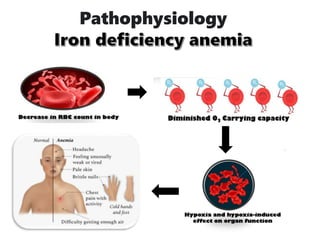 IRON DEFIENCY ANEMIA.pptx | Blood Disorders | Diseases and Conditions