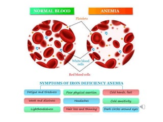 IRON DEFIENCY ANEMIA.pptx
