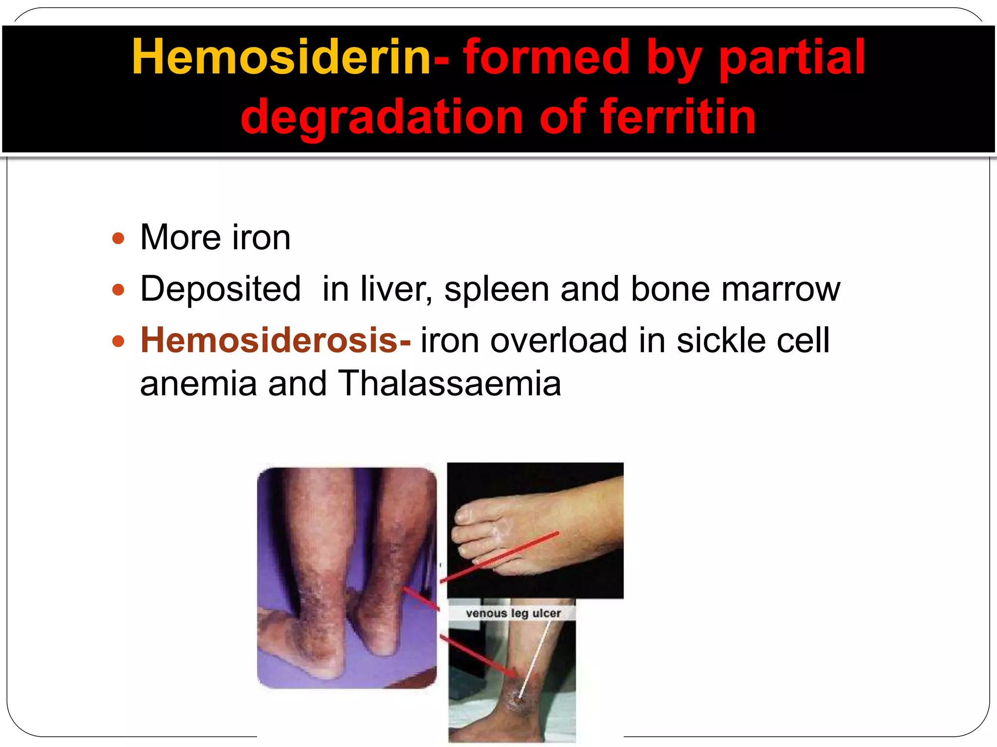 Iron metabolism | PPTX