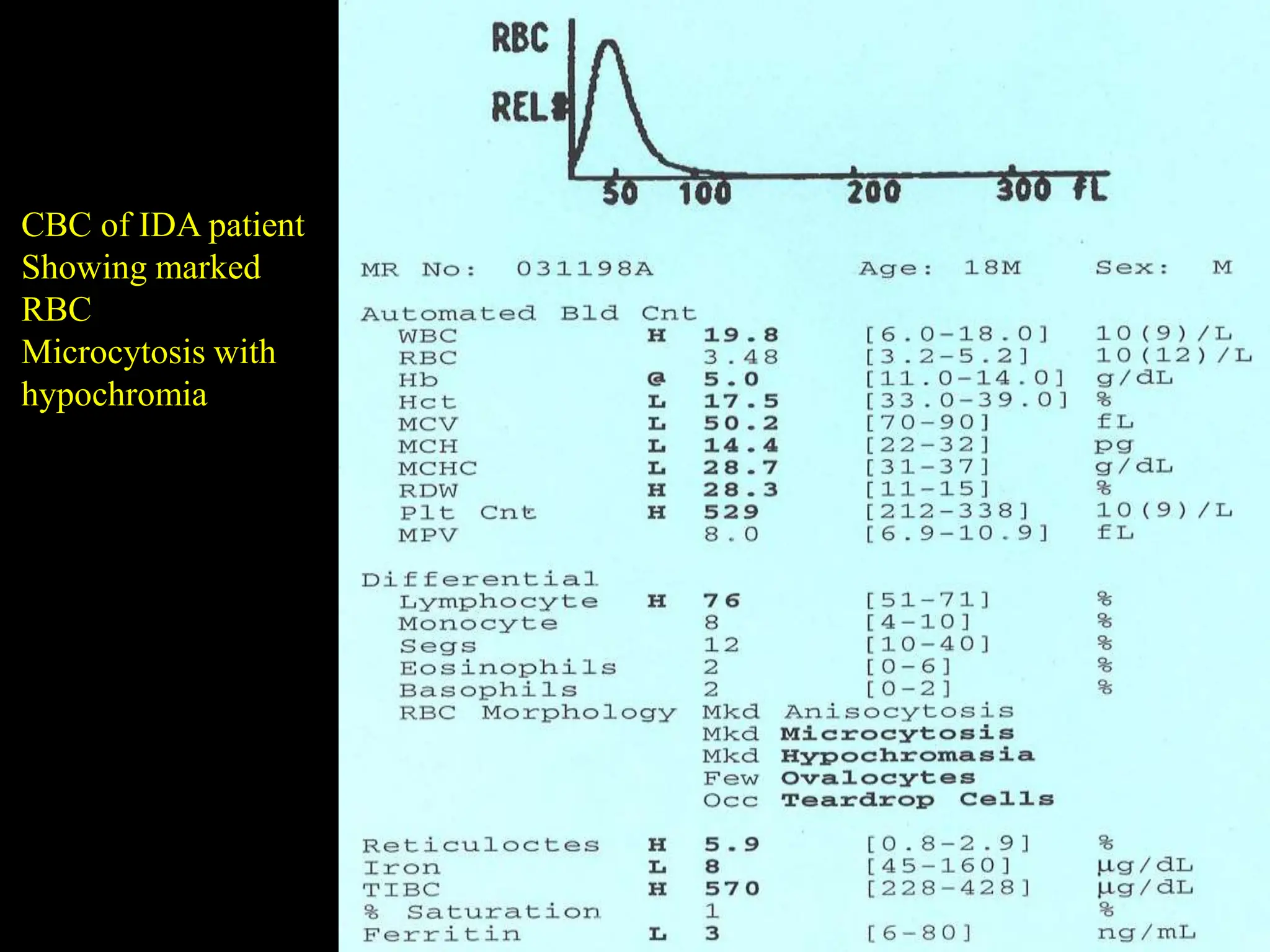 IRON METABOLISM & MICROCYTIC HYPOCHROMIC ANAEMIAS.pptx