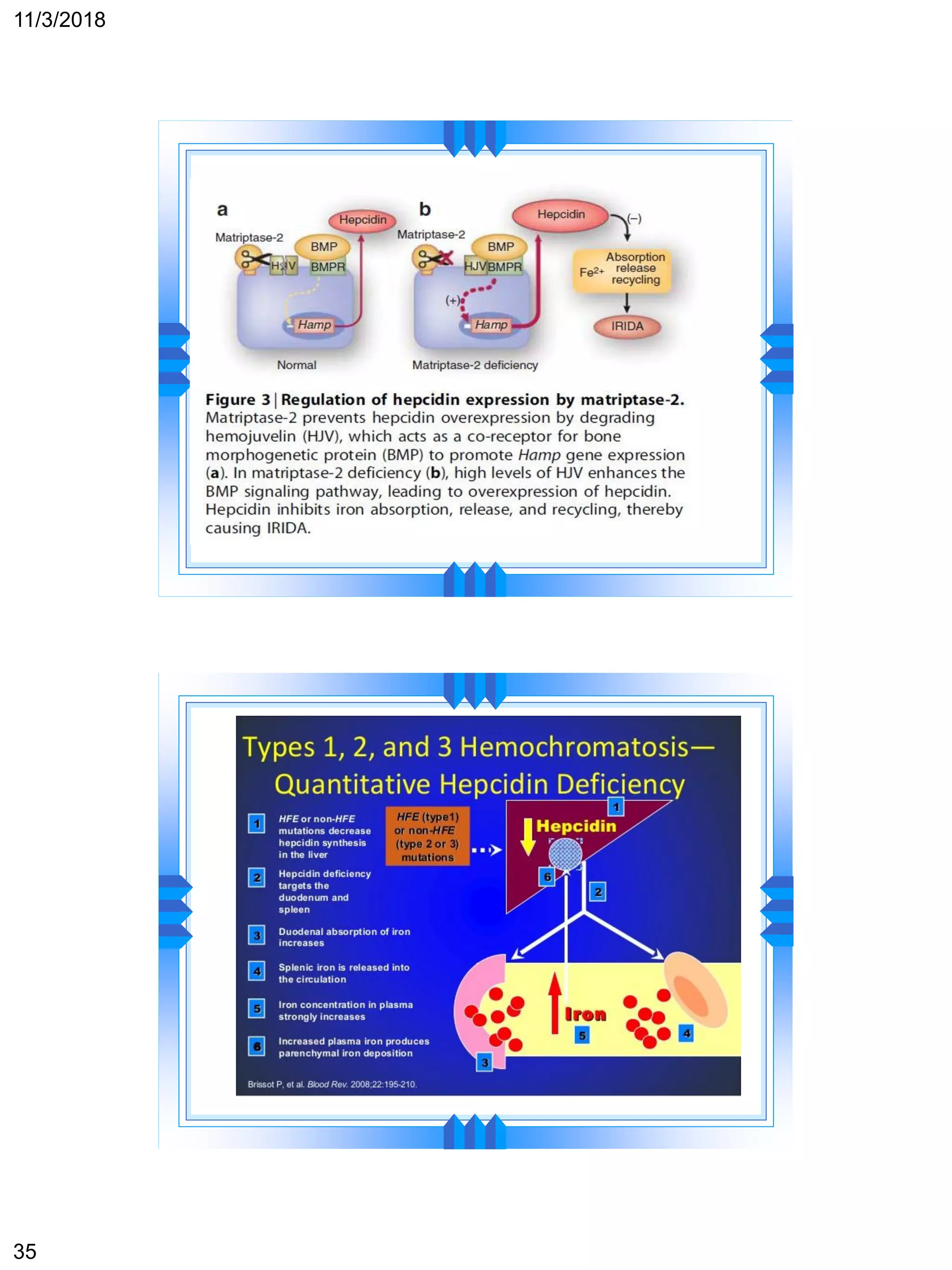 Iron refractory iron deficiency anemia1 | PDF